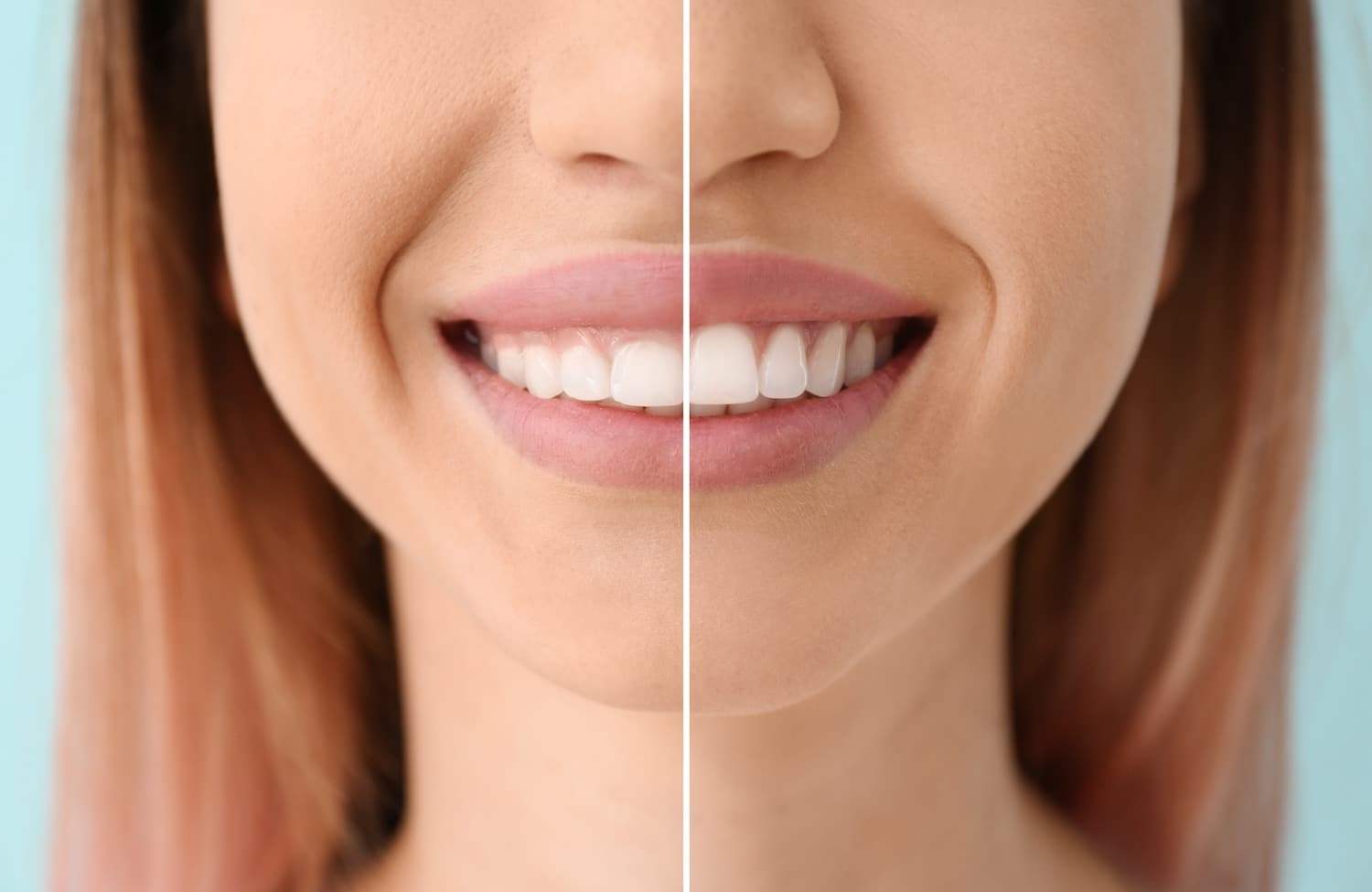 Gum Contouring Healing: Your Recovery Roadmap - Smile Vegas Dental